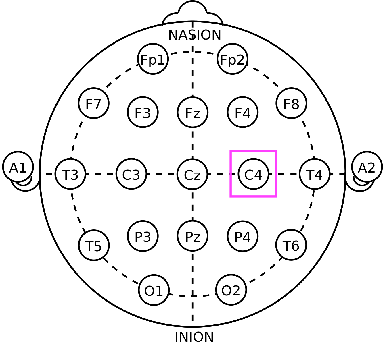 GitHub - janlucasandmann/Brainbridge: Single channel EEG data analysis