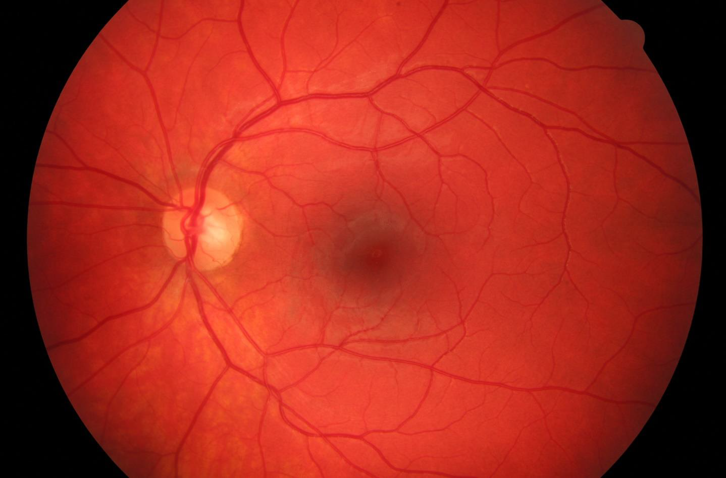 GitHub - m0zzarella/Fundus-Imaging: Extracting blood vessels from ...