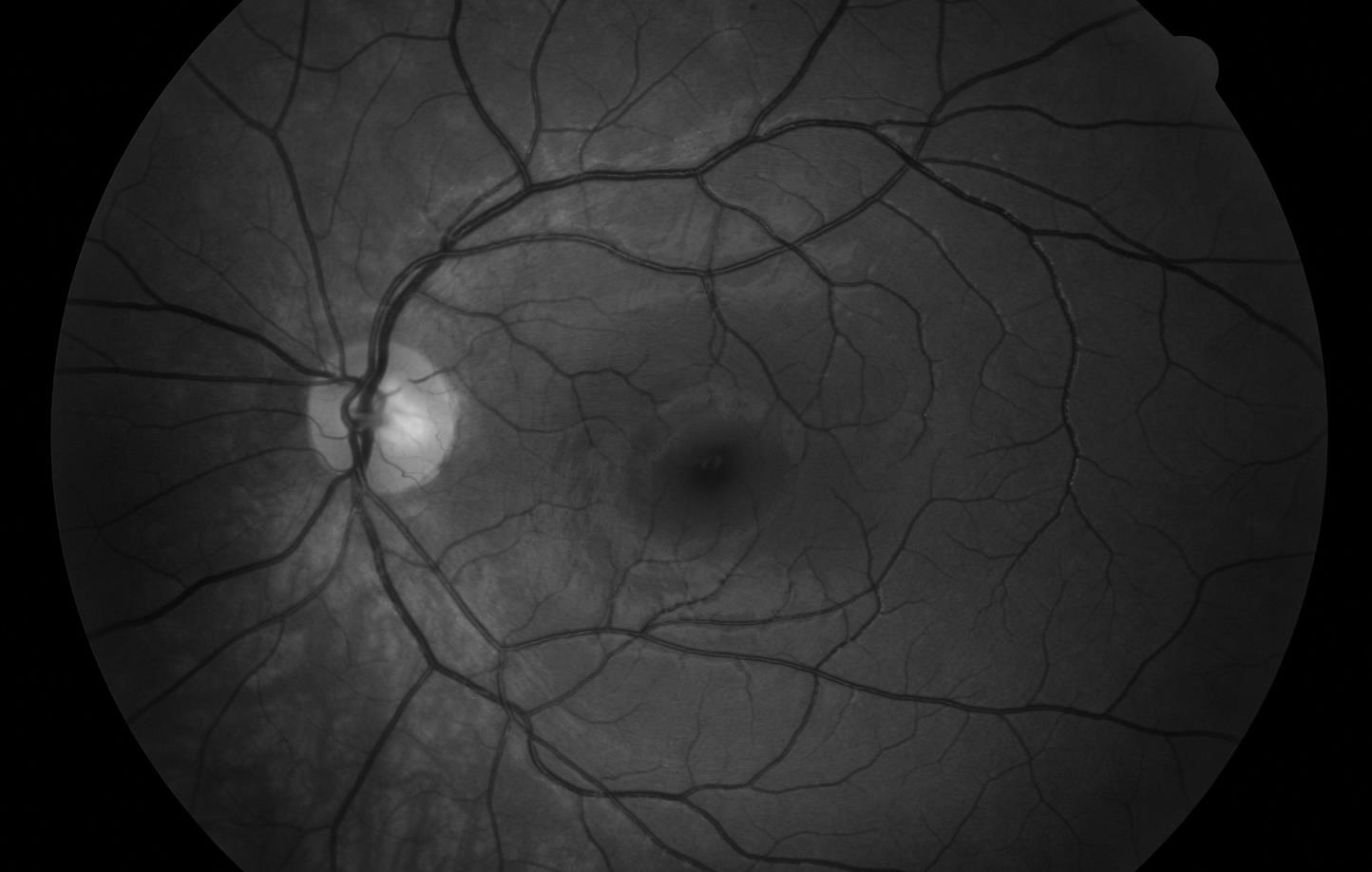 GitHub - m0zzarella/Fundus-Imaging: Extracting blood vessels from ...
