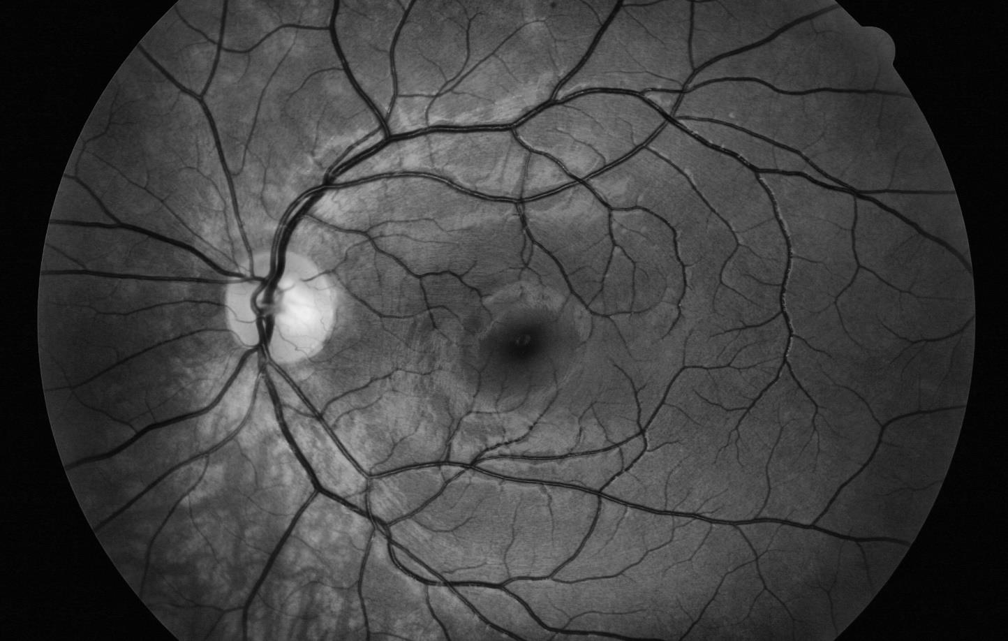 GitHub - m0zzarella/Fundus-Imaging: Extracting blood vessels from ...