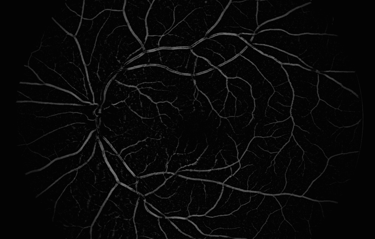 GitHub - m0zzarella/Fundus-Imaging: Extracting blood vessels from ...