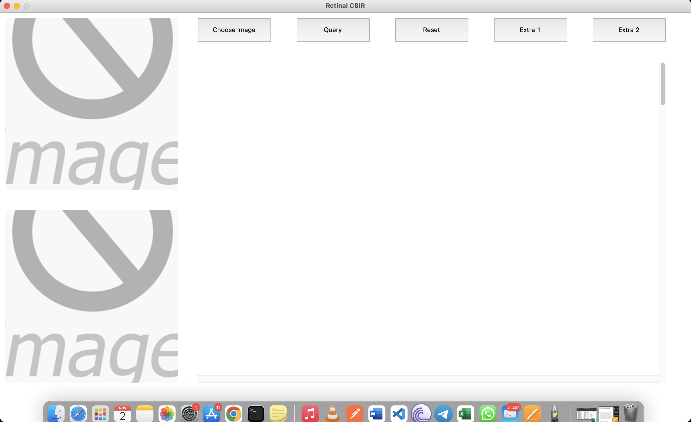 GitHub - BeKingsman/Retinal-CBIR
