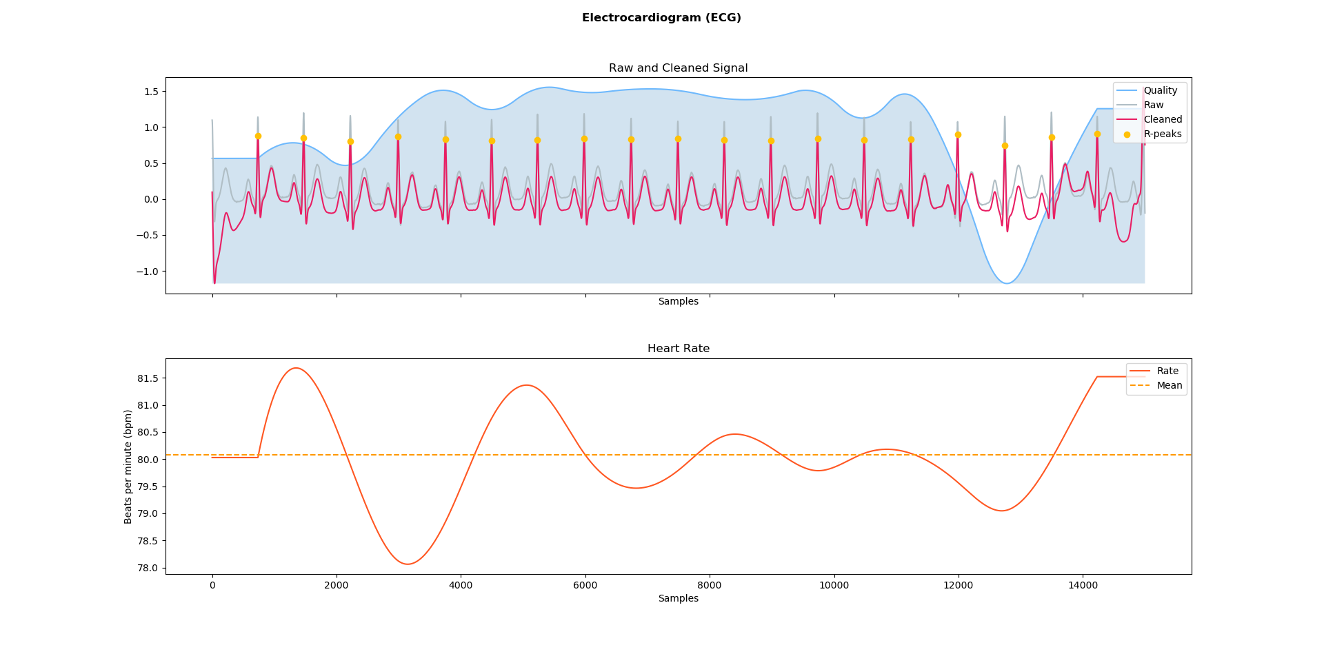 Include quality in ECG plot · Issue #191 · neuropsychology/NeuroKit ...