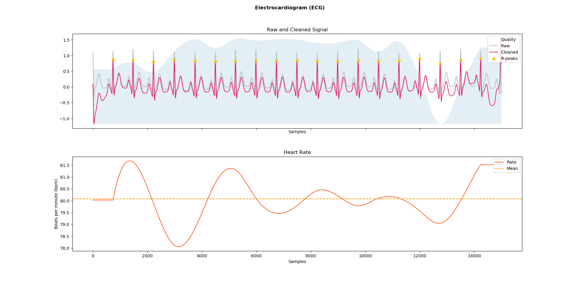 Include quality in ECG plot · Issue #191 · neuropsychology/NeuroKit · GitHub