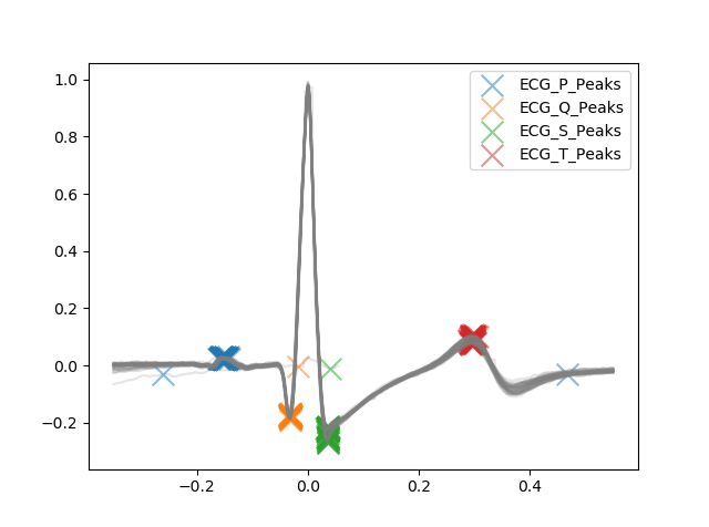 How to change plot marker in ecg_delineate? · Issue #224 ...