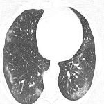 GitHub - AhmetFurkanDEMIR/Deep-Learning-with-PyTorch-V4: Deep-Learning ...