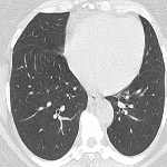 GitHub - AhmetFurkanDEMIR/Deep-Learning-with-PyTorch-V4: Deep-Learning ...