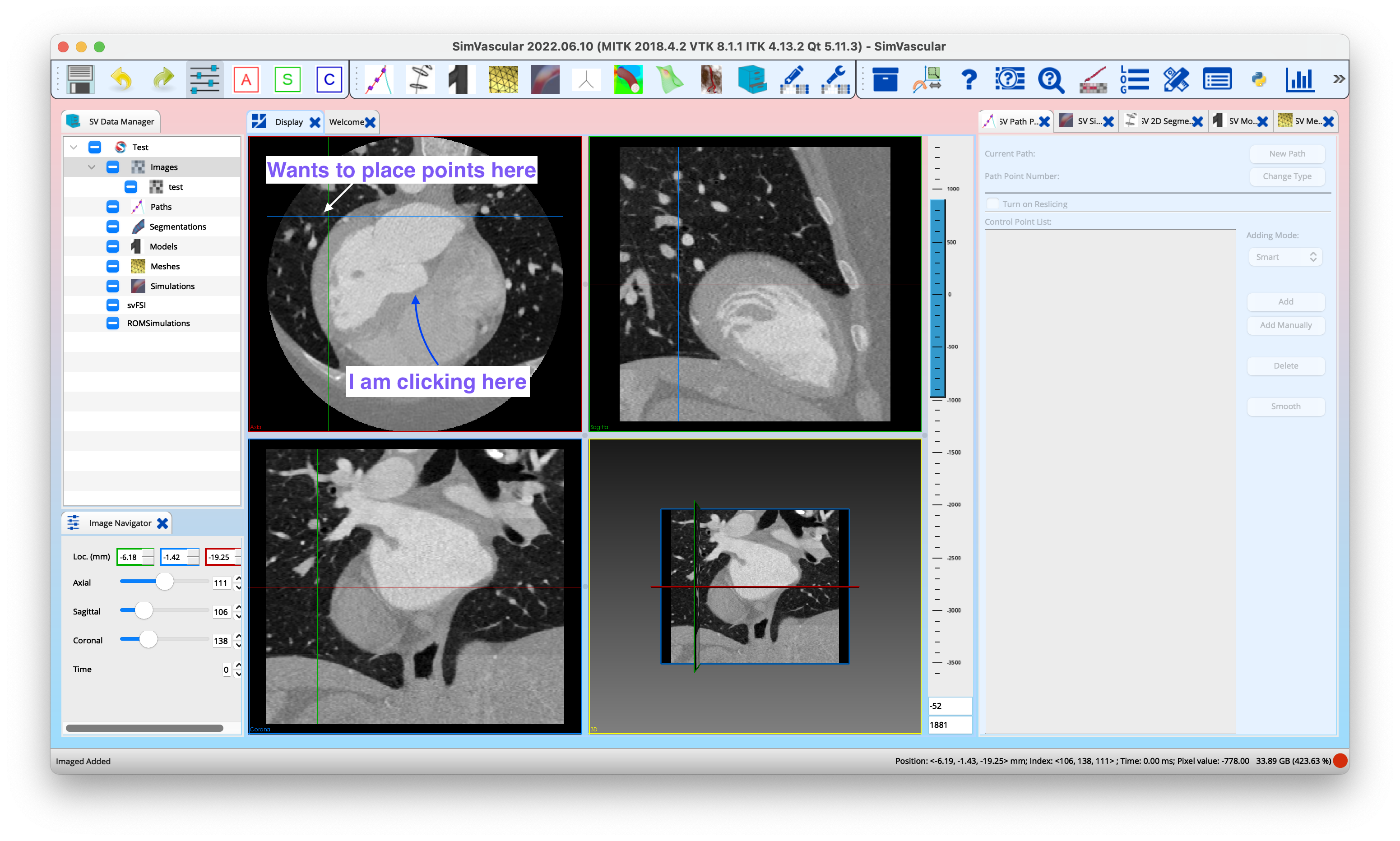 MacOS Cursor Mismatch in Display Panels · Issue #980 · SimVascular/SimVascular · GitHub