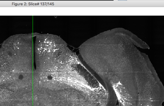 Tissue creeping in on ventral surface from the outside messes up ...