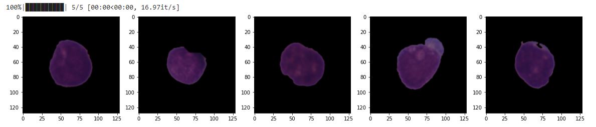 GitHub - shaikhulfuad/Leukemia_Detection