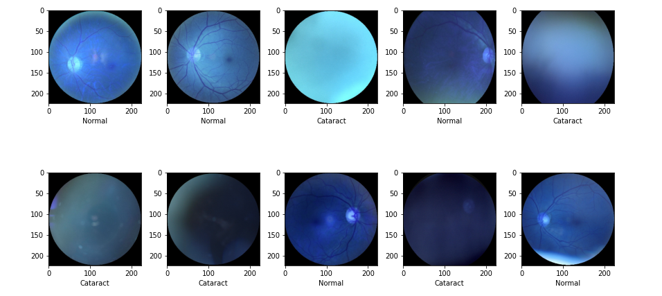 GitHub - shaikhulfuad/Human-Eye-Diagnosis-for-Cataract-Detection