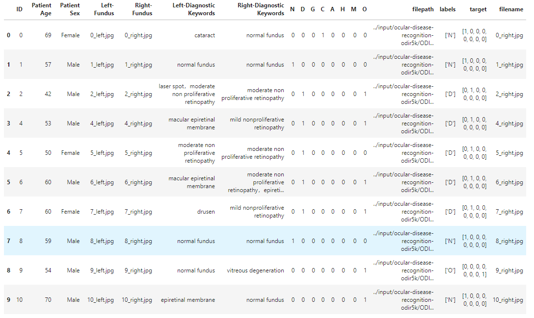 GitHub - shaikhulfuad/Human-Eye-Diagnosis-for-Cataract-Detection