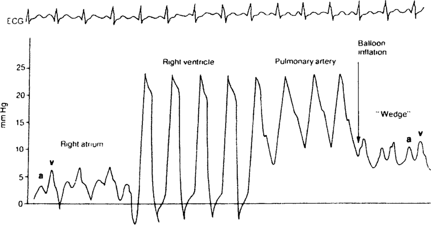 PA Waveforms: Improve Clinical Accuracy and Realism · Issue #83 ...