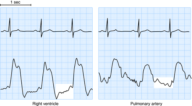 PA Waveforms: Improve Clinical Accuracy and Realism · Issue #83 ...
