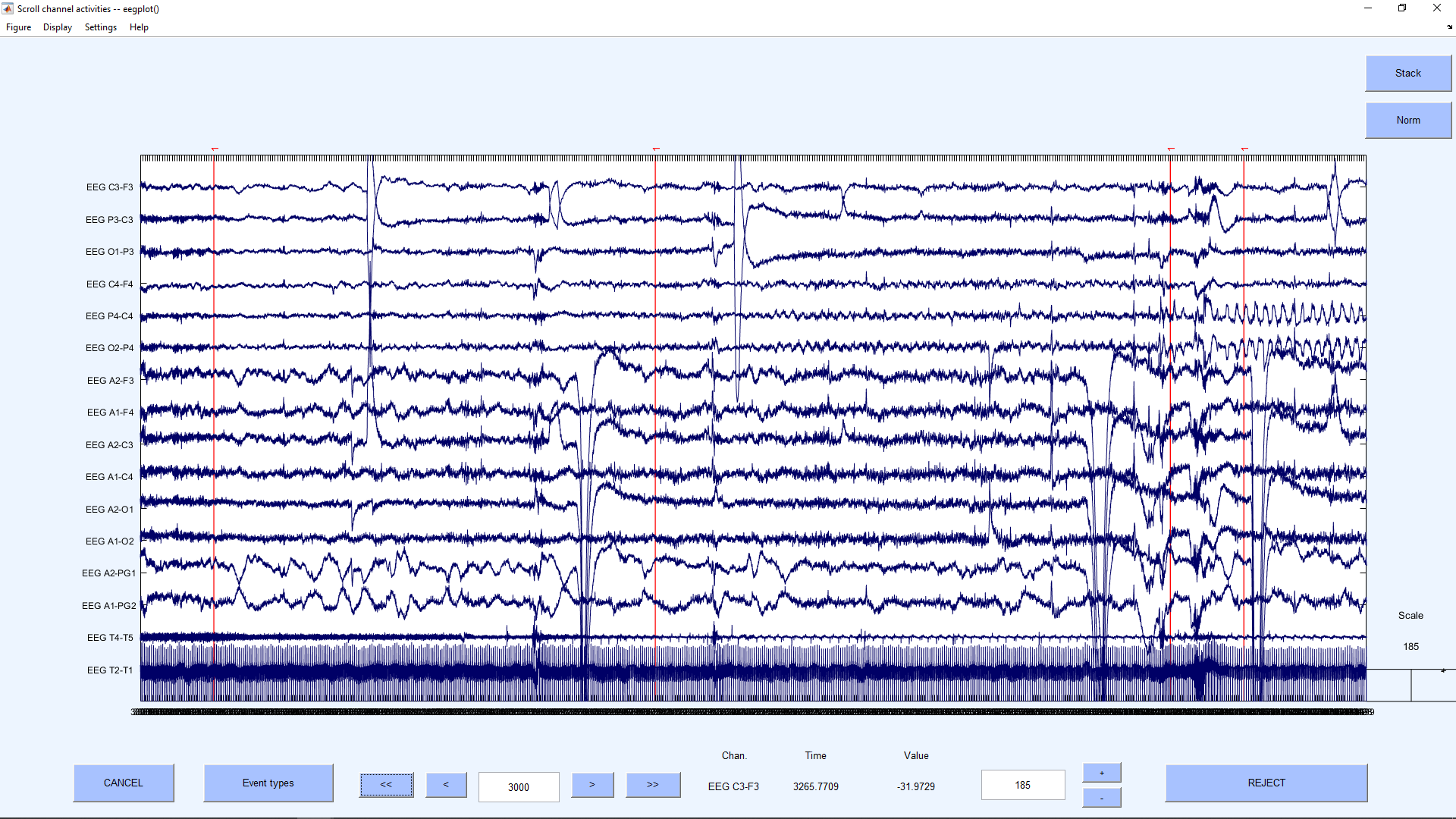 Eeglab Edf Annotations Not Properly Loaded · Issue 47 · Sccn Eeglab · Github