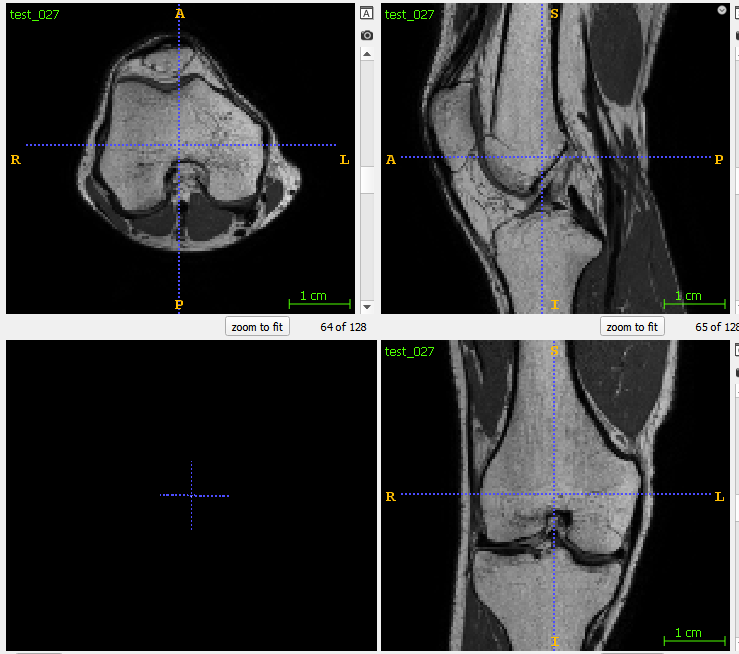 GAN questions · Issue #902 · Project-MONAI/MONAI · GitHub