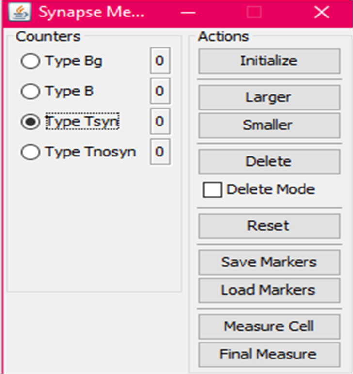 GitHub - anaacayuela/SynapseMeasures_: This ImageJ/Fiji plugin was developed to try to quantify ...