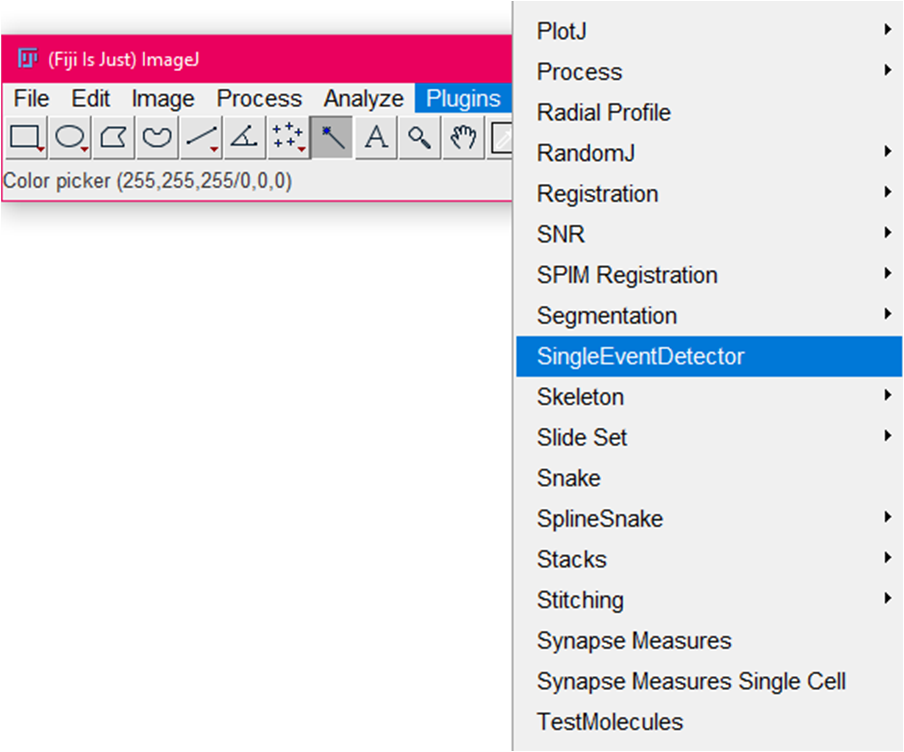 GitHub - anaacayuela/SingleEventDetector_: This ImageJ/Fiji plugin was developed to provide a ...