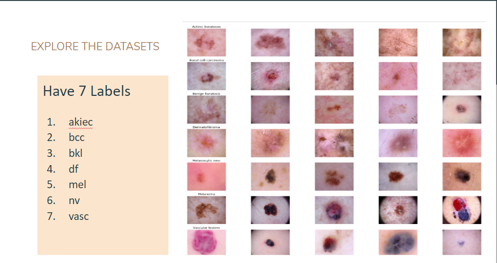 GitHub - Triginarsa/skin-cancer: DPS 4B: Automated Diagnosis of ...