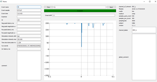 Feature: Shifting signal in GUI in y-direction · Issue #33 · neuromti/tool-offspect · GitHub