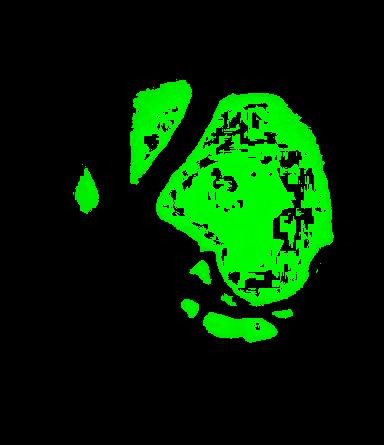 GitHub - Joshuajrodrigues/Glaucoma-detection-using-fuzzy-c-strange ...