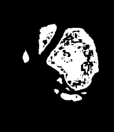 GitHub - Joshuajrodrigues/Glaucoma-detection-using-fuzzy-c-strange ...