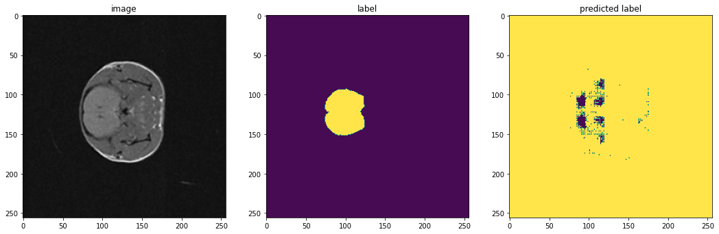 strange and bad results from training 3d segmentation model · Project ...