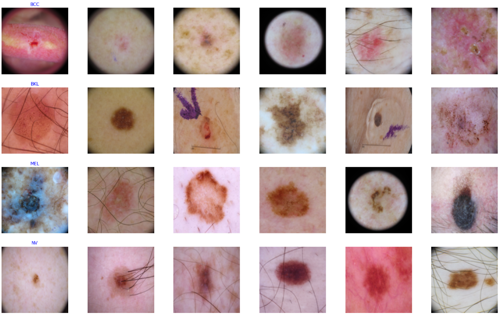 GitHub - Julio-M39/02-SkinLesion-Classification