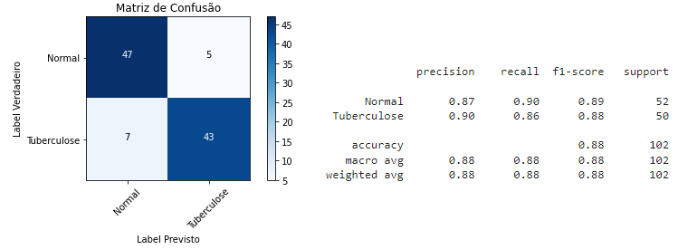 GitHub - Julio-M39/01-Tuberculosis-Classification