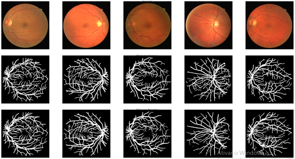 GitHub - Julio-M39/10-Segmentation_of_Retina_Vessels