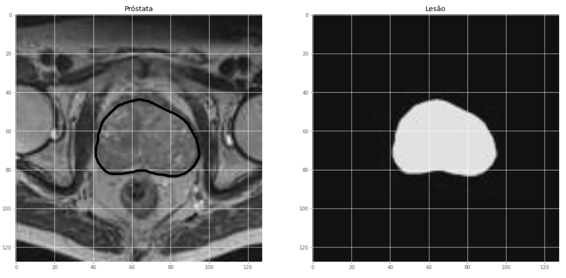 GitHub - Julio-M39/12-Segmentation_Prostate_Deformations_with_Deep_Learning