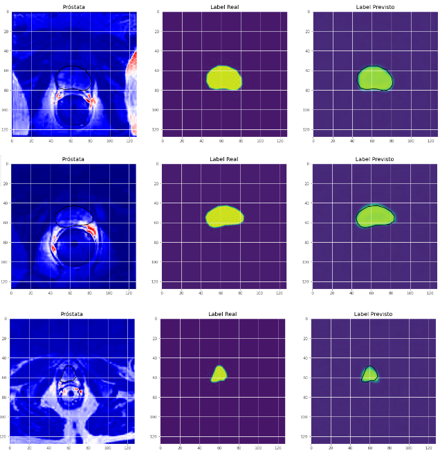 GitHub - Julio-M39/12-Segmentation_Prostate_Deformations_with_Deep_Learning