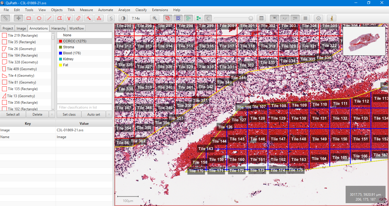 GitHub - bluewhale28/Classification-of-images-with-clear-cell-renal ...