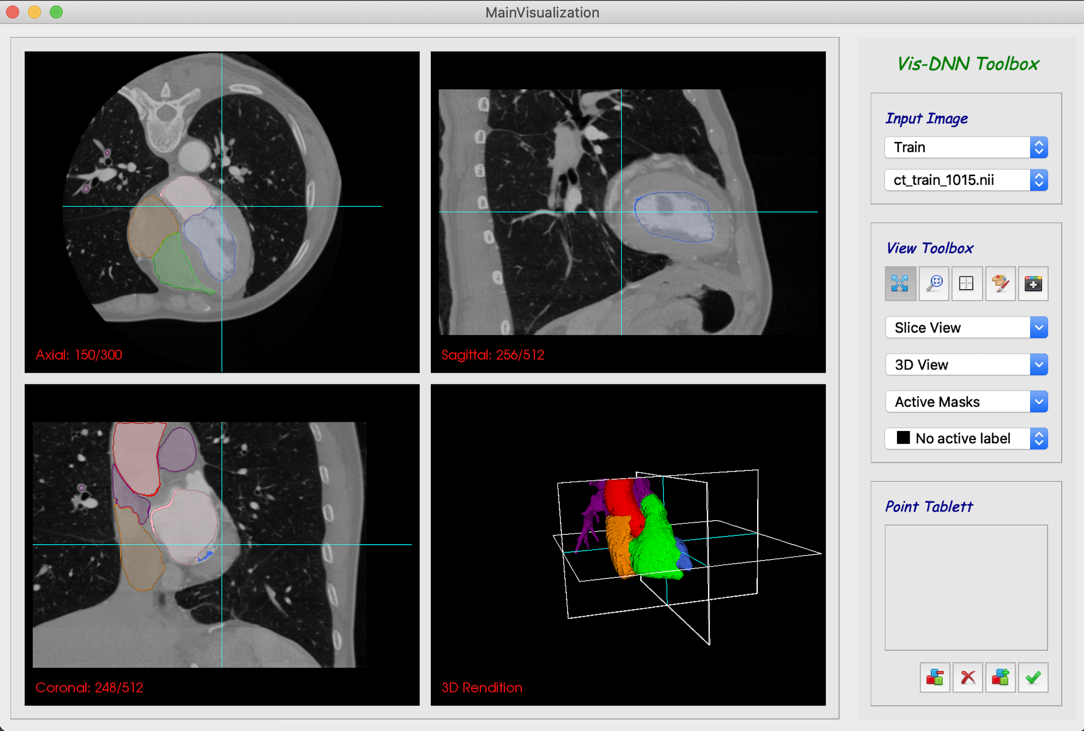 GitHub - jstoor-elf/CM2004-Medical-Image-Visualization-Project