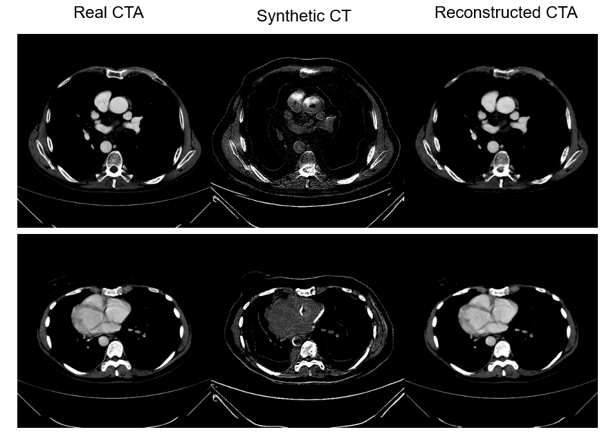 GitHub - Libo-Xu/GAN-based-Thoracic-Aorta-Segmentation