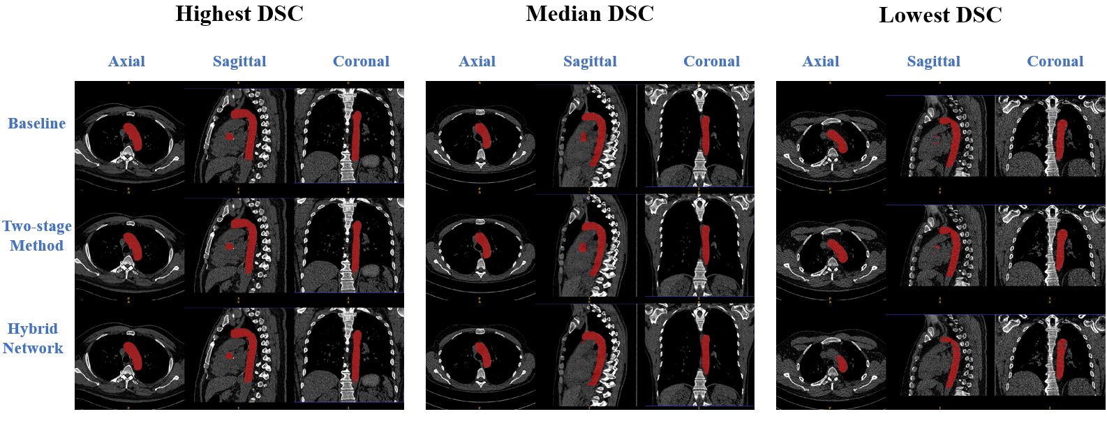 GitHub - Libo-Xu/GAN-based-Thoracic-Aorta-Segmentation