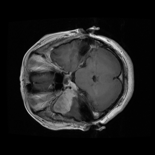 GitHub - Jacky-Android/mmsegmentation-for-mri