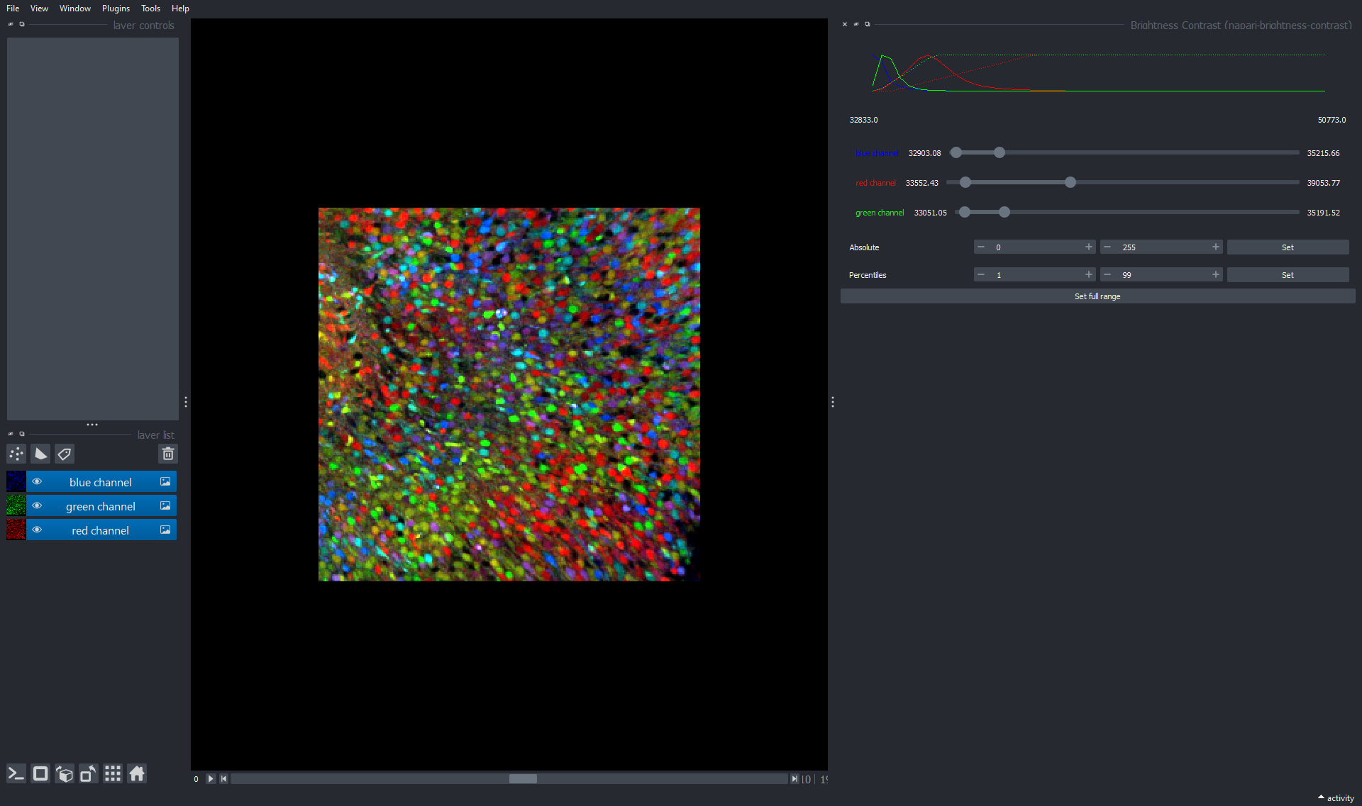 Adjust contrast · Issue #1 · LaboratoryOpticsBiosciences/napari-brainbow-diagnose · GitHub