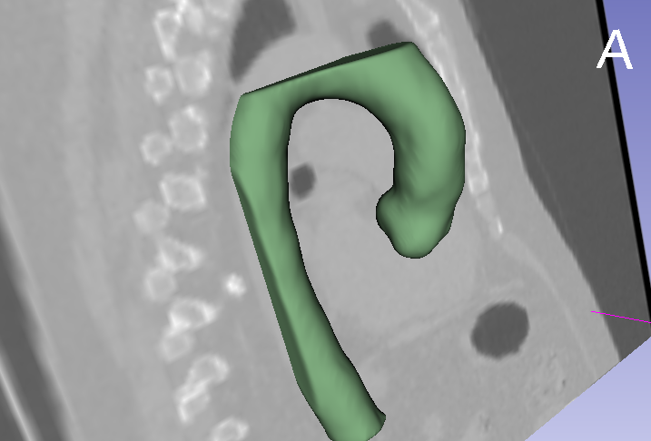 Segmentations getting arbitrary cutoffs · Issue #220 · wasserth ...