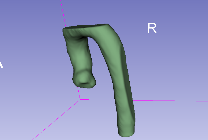 Segmentations getting arbitrary cutoffs · Issue #220 · wasserth/TotalSegmentator · GitHub