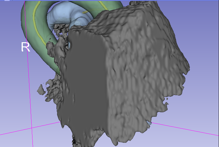 Segmentations getting arbitrary cutoffs · Issue #220 · wasserth/TotalSegmentator · GitHub