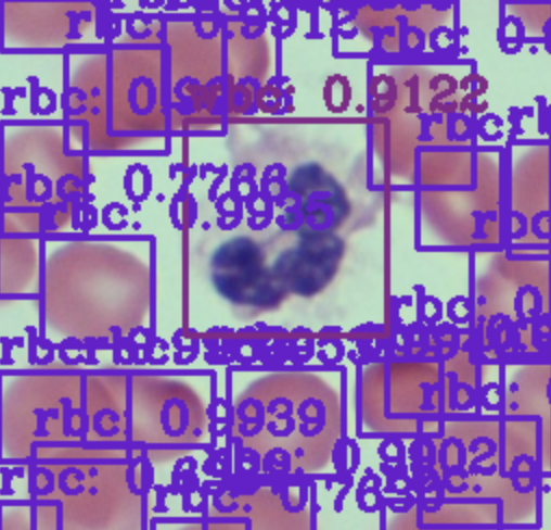 GitHub - suryatejak969/blood_cells_detection_using_yolov4