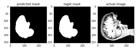 GitHub - malay-pal/UNet: MRI skull Stripping using UNet