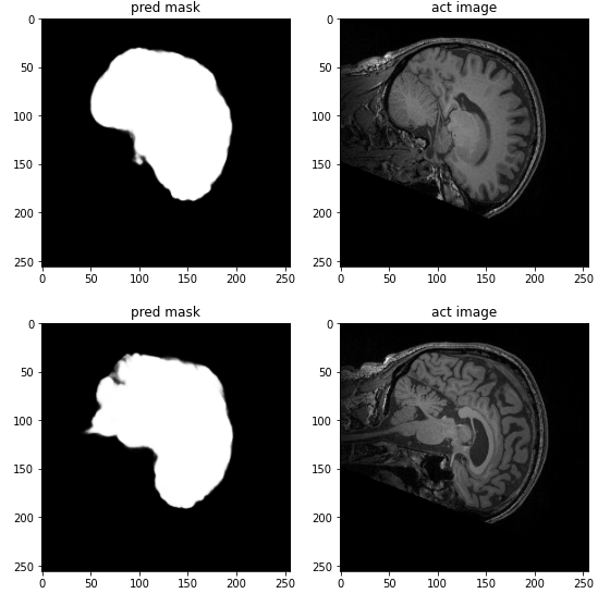 GitHub - malay-pal/UNet: MRI skull Stripping using UNet