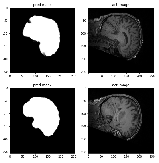 GitHub - malay-pal/UNet: MRI skull Stripping using UNet