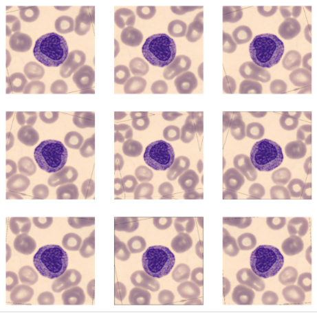 GitHub - malay-pal/CNN_classification: WBC classification using CNN