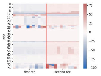 Question: motion estimation parameters & results interpretation · Issue #1382 · SpikeInterface ...