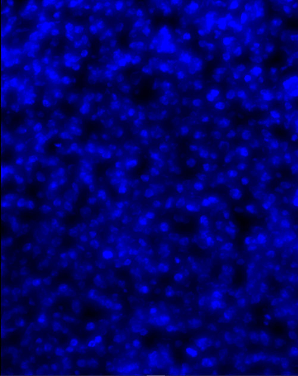 How to segment a DAPI image with blurred vision · Issue #529 ...