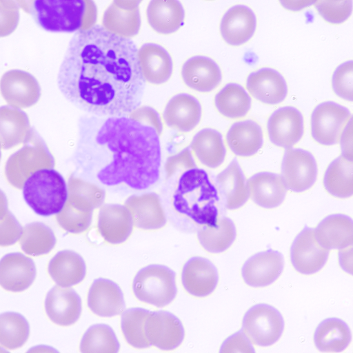 GitHub - petermervart/RedBloodCellsDetection