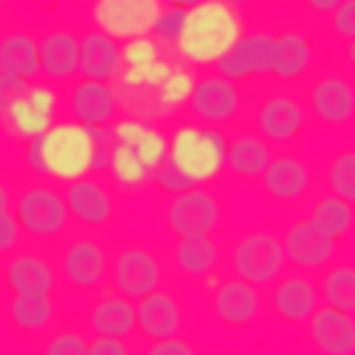 GitHub - petermervart/RedBloodCellsDetection